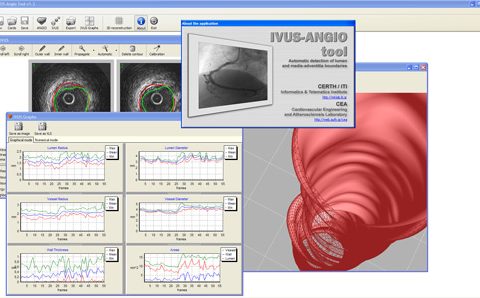 Latest News – IVUS Angio Tool